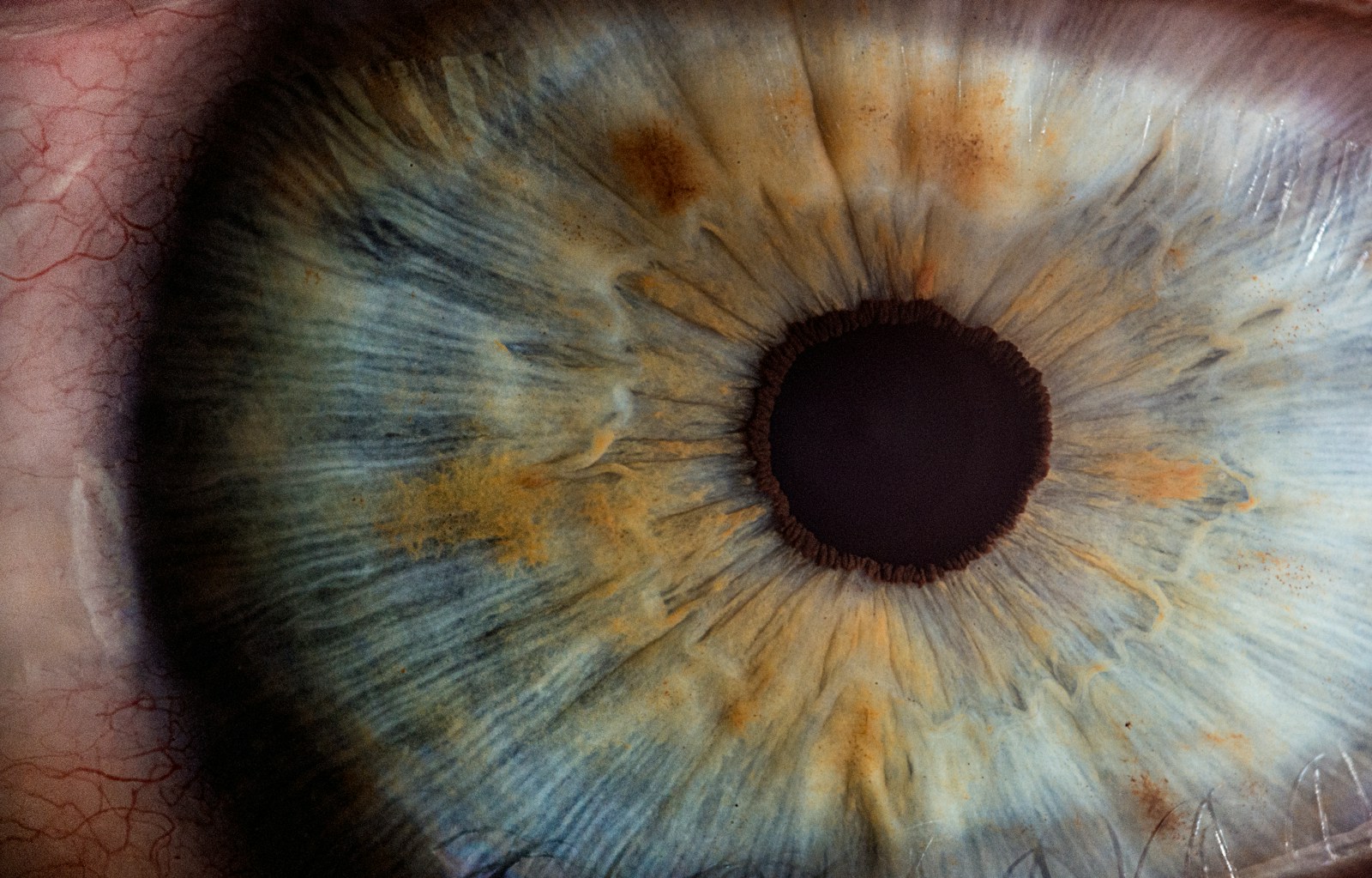 Blog: What Laser Eye Surgery Really Feels Like - The Harley Street Eye ...